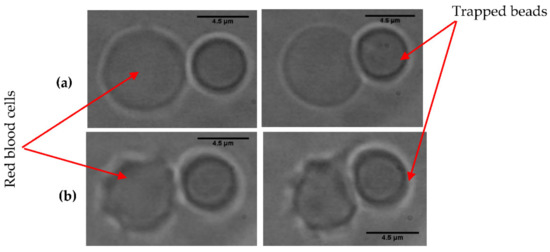 Lateral Deformation of Human Red Blood Cells by Optical Tweezers