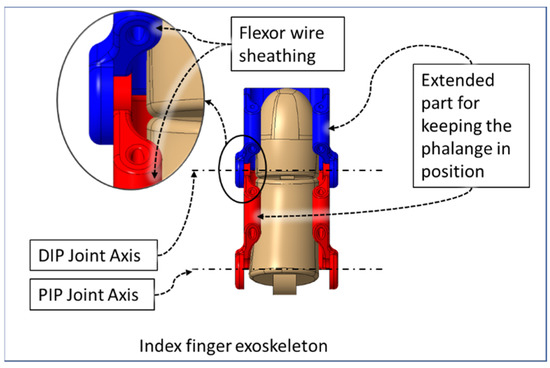 Flexohand: A Hybrid Exoskeleton-Based Novel Hand Rehabilitation Device