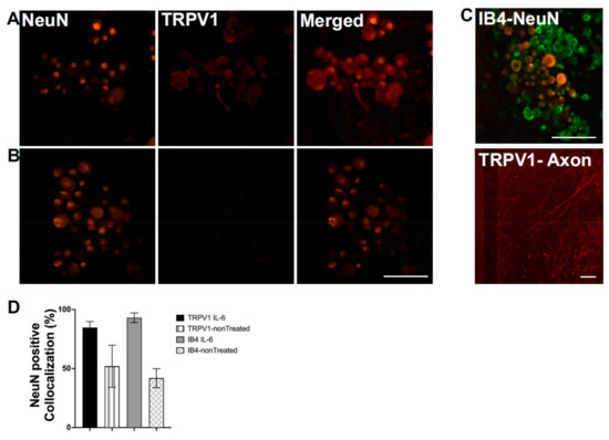 Investigating the Function of Adult DRG Neuron Axons Using an In Vitro ...