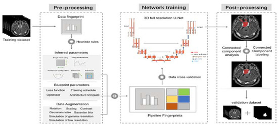 Three Dimensional Semantic Segmentation Of Pituitary Adenomas Based On The Deep Learning