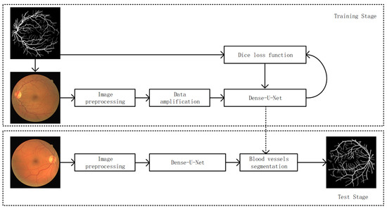 Blood Vessel Segmentation of Retinal Image Based on Dense-U-Net Network