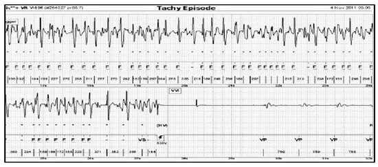 Micromachines | Free Full-Text | A Review of the Commercially Available ...