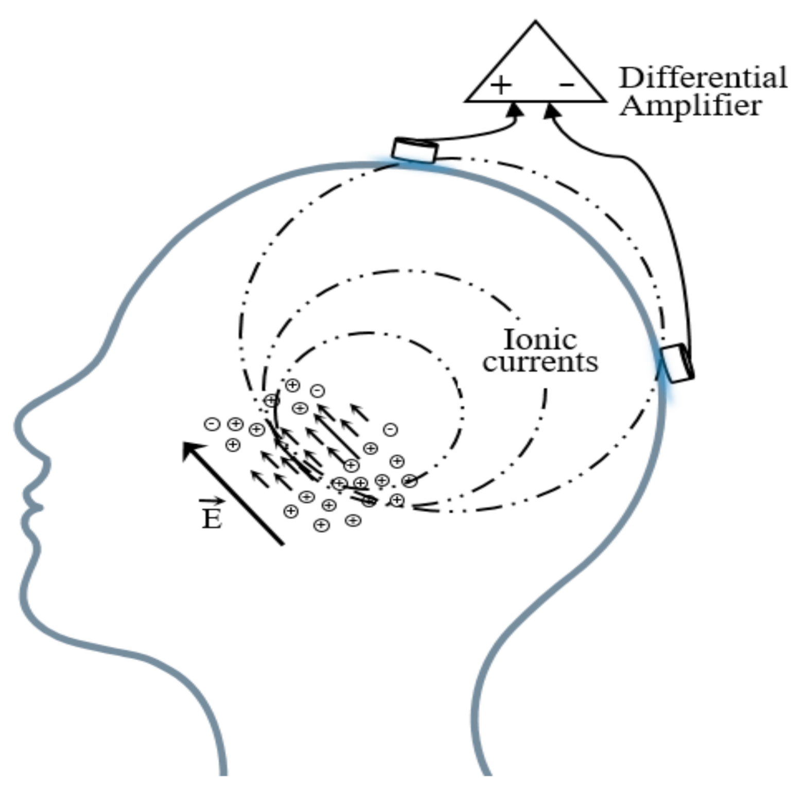 State of the Art of Non-Invasive Electrode Materials for Brain–Computer ...