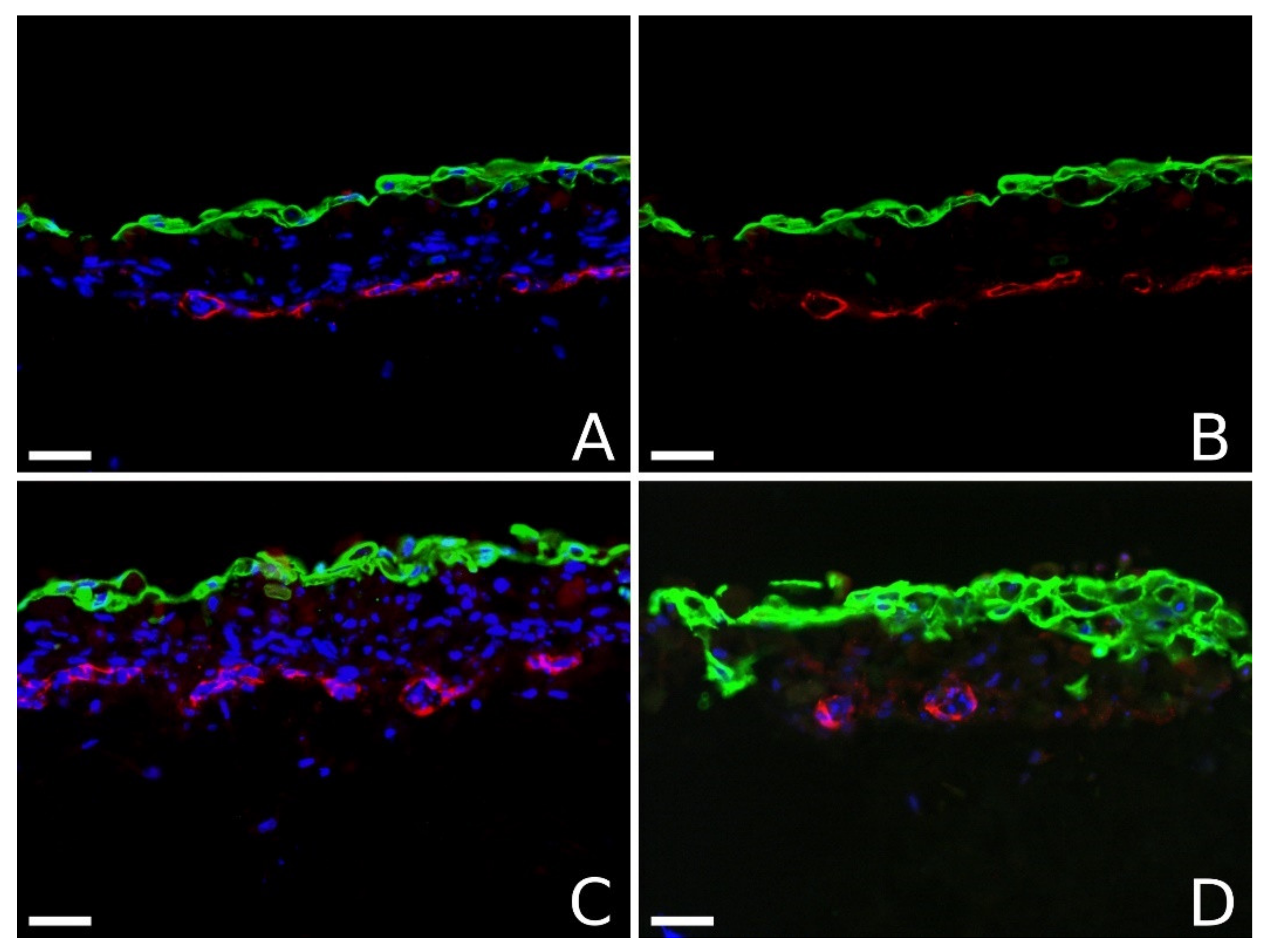 Capillary-like Formations of Endothelial Cells in Defined Patterns ...