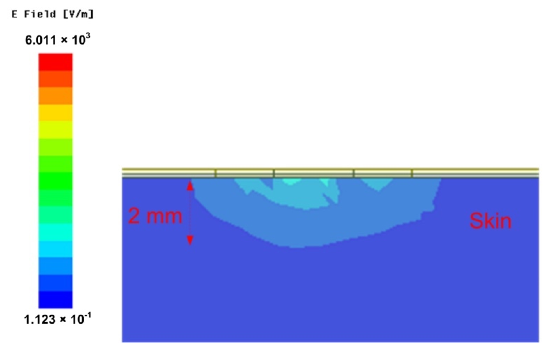 Flexible Microwave Biosensor for Skin Abnormality Detection Based on ...