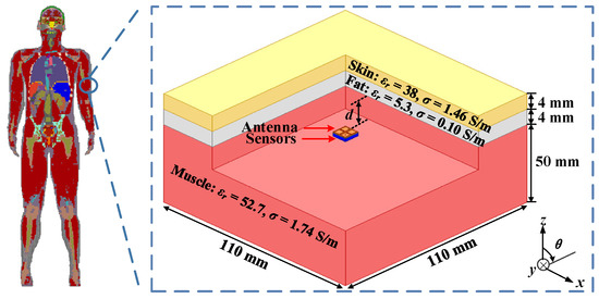 A Circularly Polarized Implantable Rectenna for Microwave Wireless ...