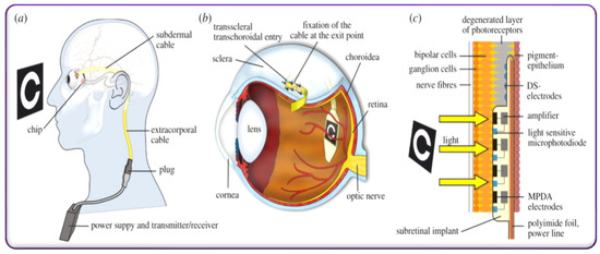 New Era of Electroceuticals: Clinically Driven Smart Implantable ...
