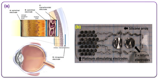 New Era of Electroceuticals: Clinically Driven Smart Implantable ...