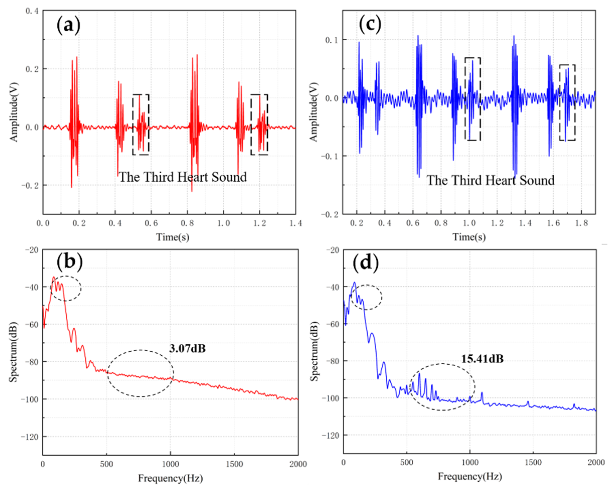 Design of a Novel Medical Acoustic Sensor Based on MEMS Bionic Fish Ear ...