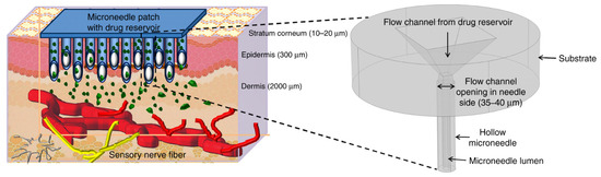 Microelectromechanical Systems (MEMS) for Biomedical Applications