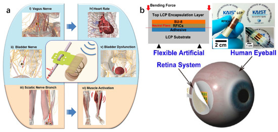 Research Progress on the Flexibility of an Implantable Neural ...