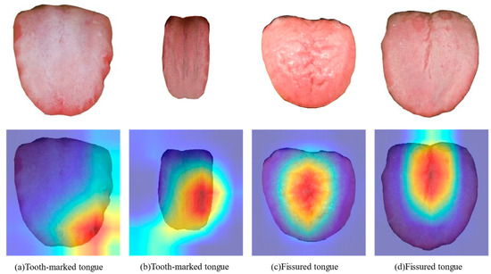 Automatic Classification Framework Of Tongue Feature Based On Convolutional Neural Networks