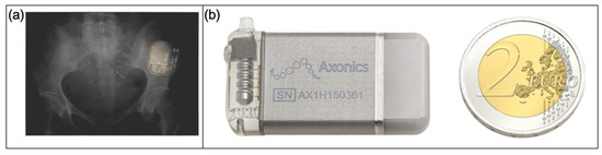 Micromachines | Free Full-Text | Advances in Assistive Electronic ...