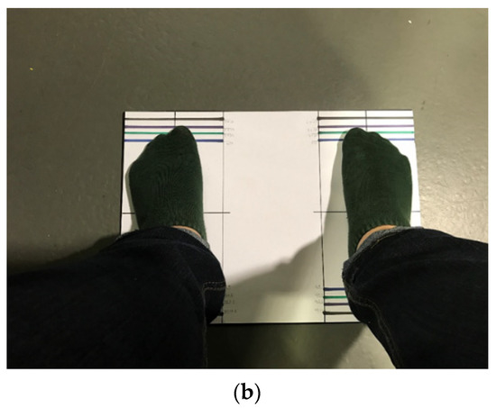 Early Notice Pointer, an IoT-like Platform for Point-of-Care Feet and ...