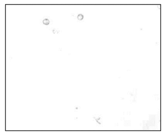 Accurate and Automatic Extraction of Cell Self-Rotation Speed in an ODEP Field Using an Area ...