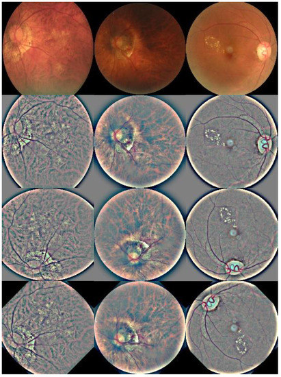 Micromachines | Free Full-Text | Multi-Label Fundus Image ...