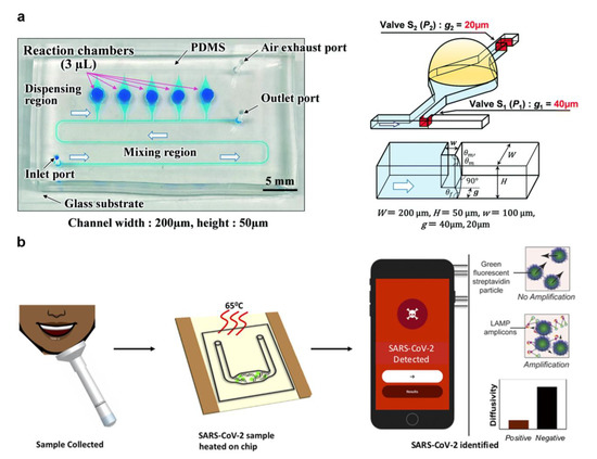 Microfluidics-Based POCT for SARS-CoV-2 Diagnostics