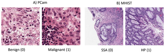 Enabling Intelligent IoTs for Histopathology Image Analysis Using Convolutional Neural Networks