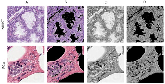 Enabling Intelligent IoTs for Histopathology Image Analysis Using Convolutional Neural Networks