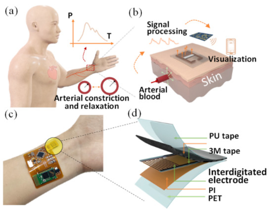On-Skin Flexible Pressure Sensor with High Sensitivity for Portable ...