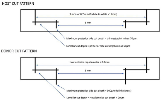 Femtosecond Laser-Assisted Ophthalmic Surgery: From Laser Fundamentals ...