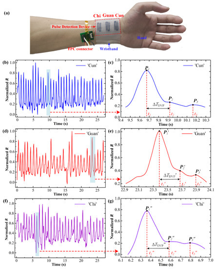 Development of Pressure Sensor Based Wearable Pulse Detection Device ...
