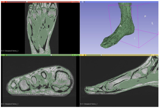 Enhanced Visualisation of Normal Anatomy with Potential Use of ...