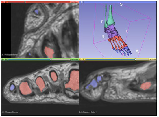 Enhanced Visualisation of Normal Anatomy with Potential Use of ...