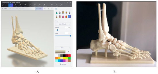 Enhanced Visualisation of Normal Anatomy with Potential Use of ...