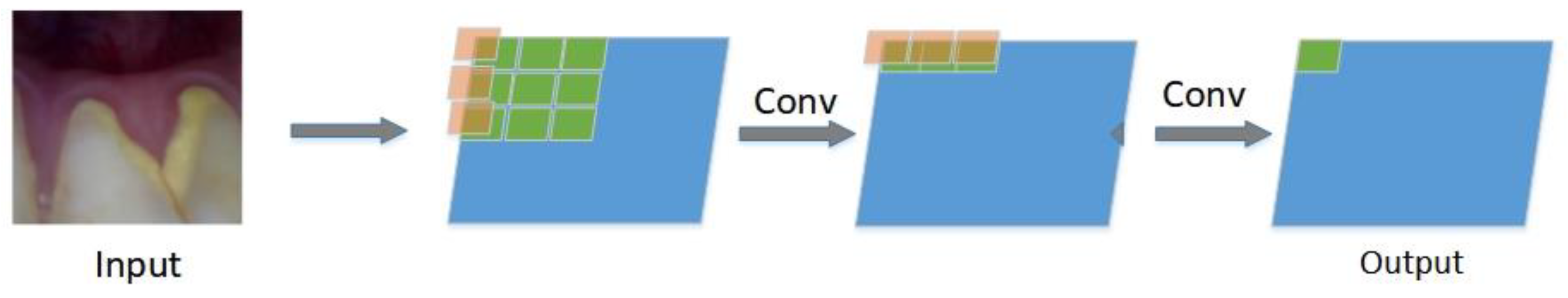Dental Lesion Segmentation Using an Improved ICNet Network with Attention