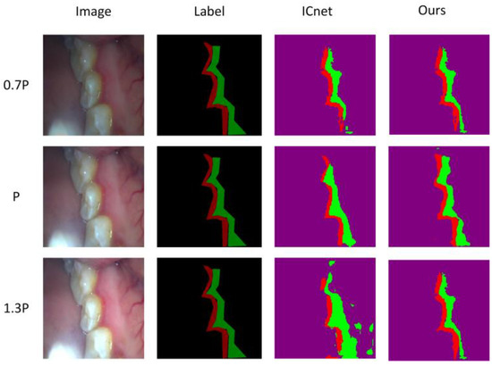 Micromachines | Free Full-Text | Dental Lesion Segmentation Using an Improved ICNet Network with ...