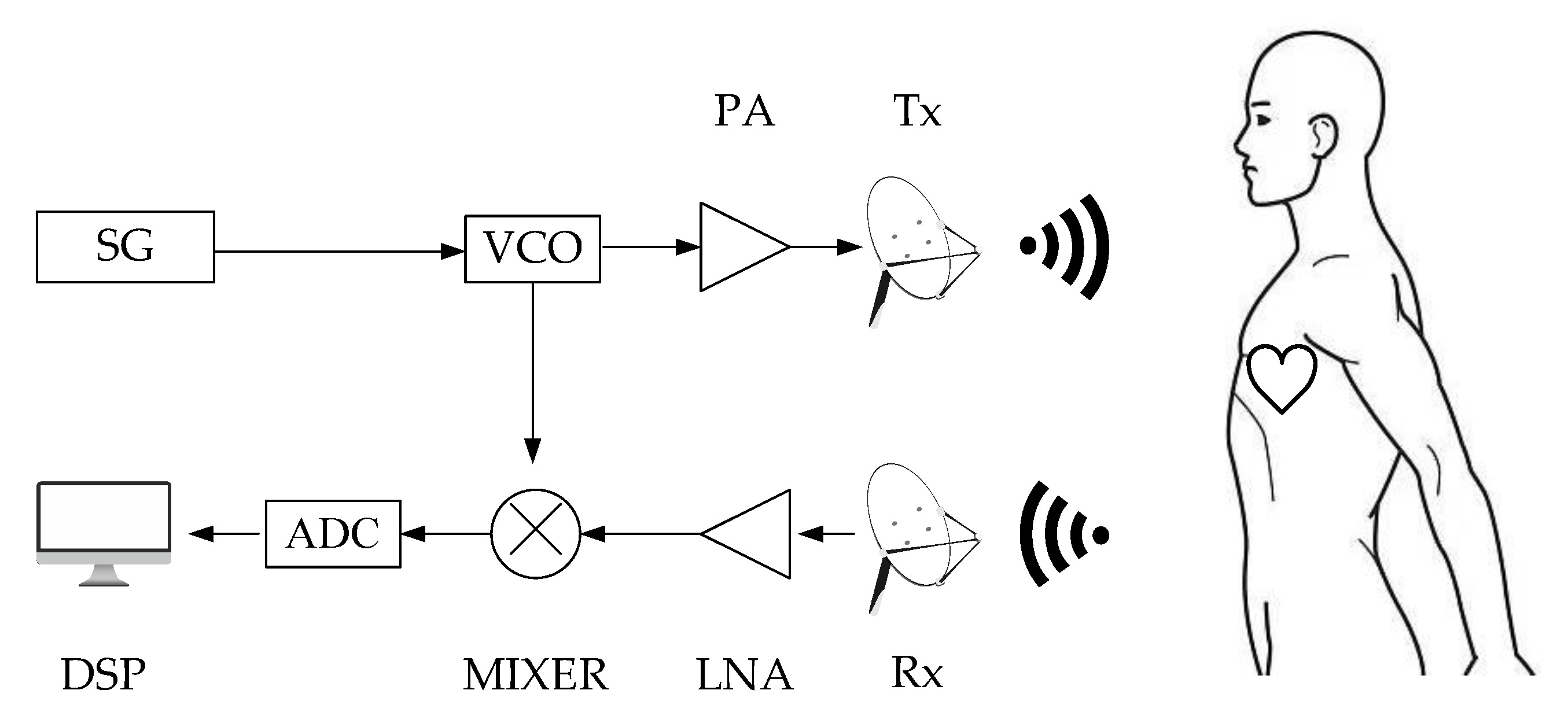 Real-Time Heart Rate Detection Method Based on 77 GHz FMCW Radar