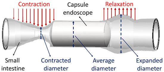 Anchoring Mechanism for Capsule Endoscope: Mechanical Design ...