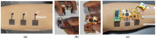 Study on Flexible sEMG Acquisition System and Its Application in Muscle ...