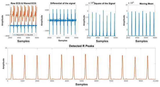 Micromachines | Free Full-Text | Internet of Things-Based ECG and ...
