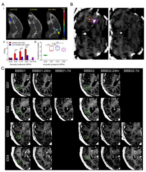 Advances in BBB on Chip and Application for Studying Reversible Opening ...