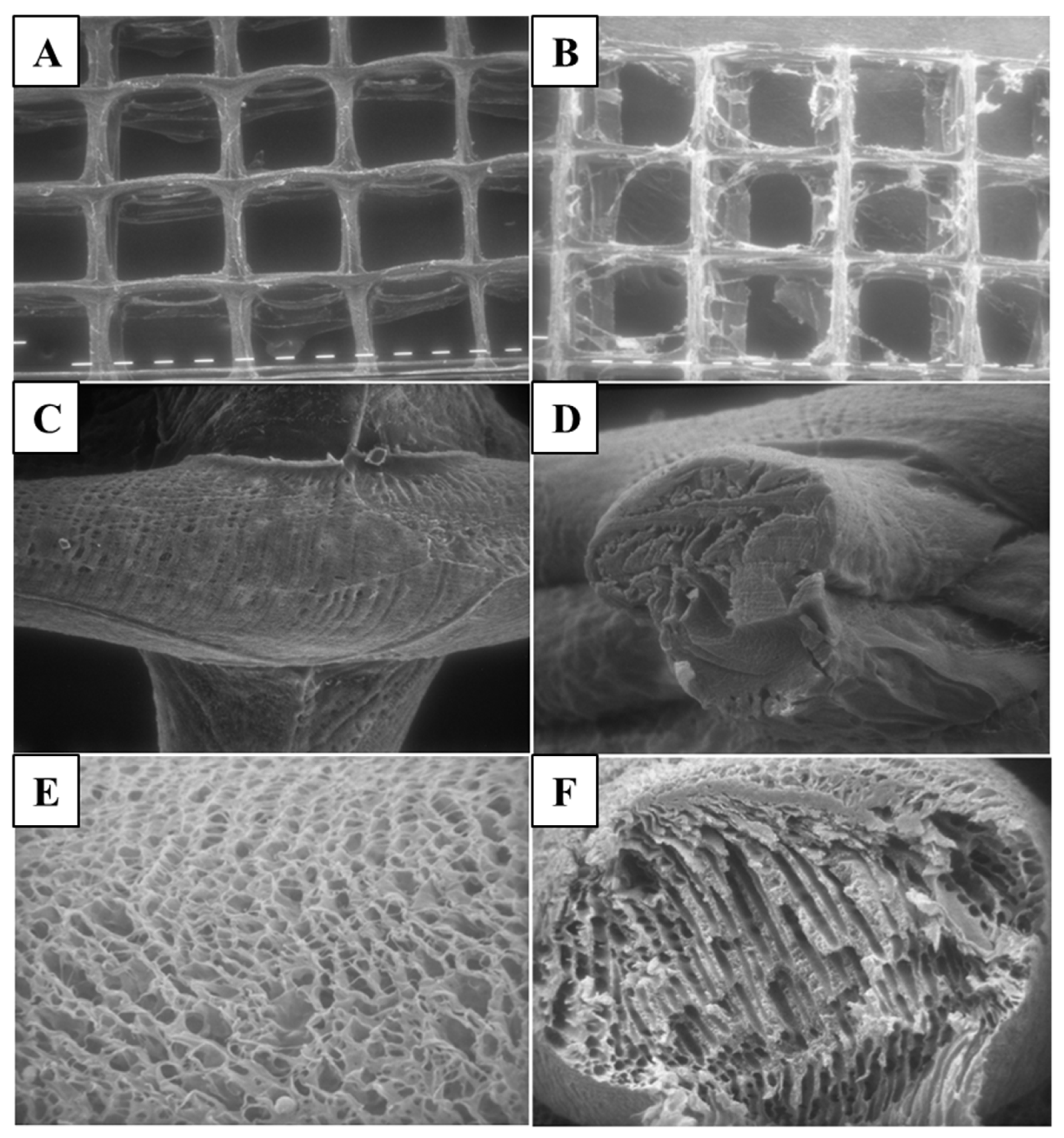3D Printed Chitosan/Alginate Hydrogels for the Controlled Release of Silver Sulfadiazine in ...