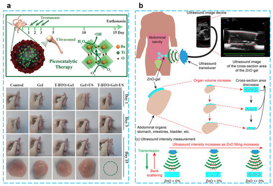 Recent Progress on Hydrogel-Based Piezoelectric Devices for Biomedical ...