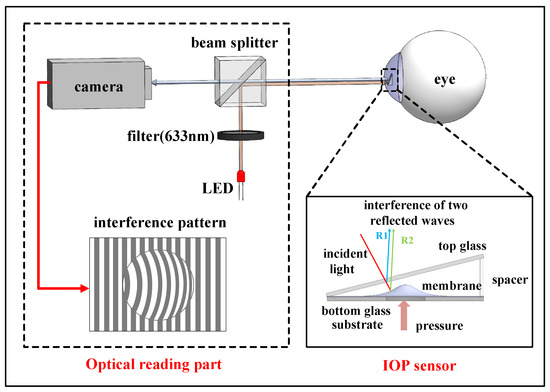 High−Accuracy Film−Integrated Optical Sensor for Real−Time Intraocular Pressure Monitoring