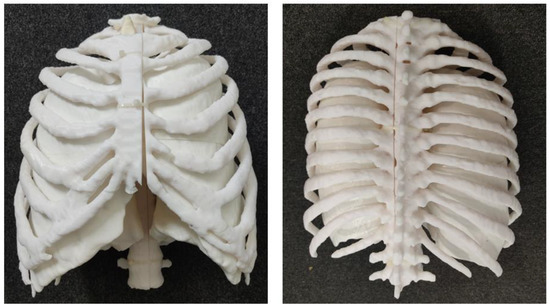 Patient-Specific 3D-Printed Low-Cost Models in Medical Education and ...