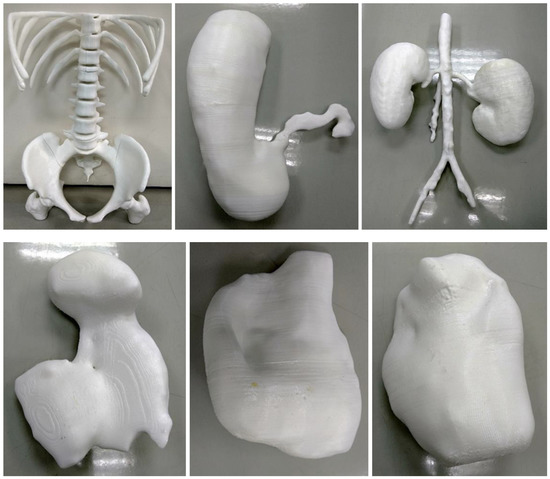Patient-Specific 3D-Printed Low-Cost Models in Medical Education and ...