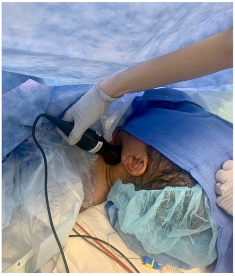 An Assessment of Carotid Flow Time Using a Portable Handheld Ultrasound ...