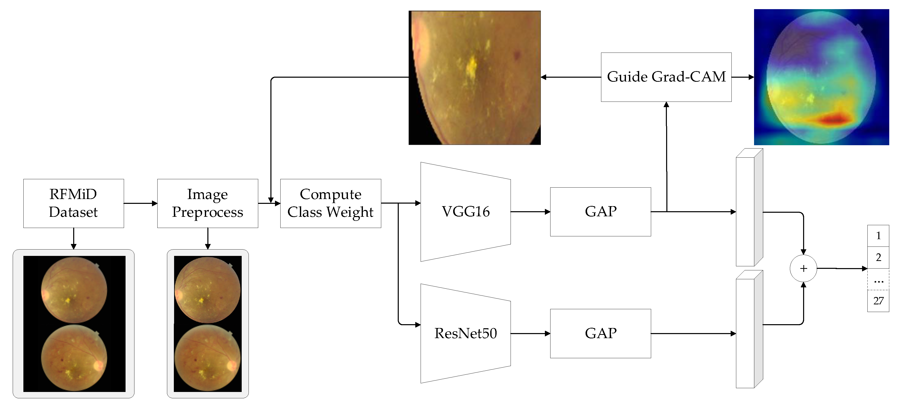 A Multi-Label Detection Deep Learning Model with Attention-Guided Image ...