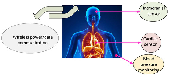 A Literature Survey with the Focus on Magnetically Coupled Wireless ...