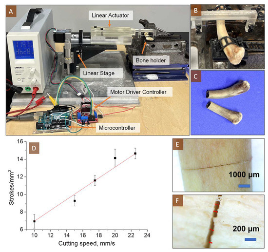 Design and Fabrication of Micro Saw Enabling Root-Side Cutting of Bone