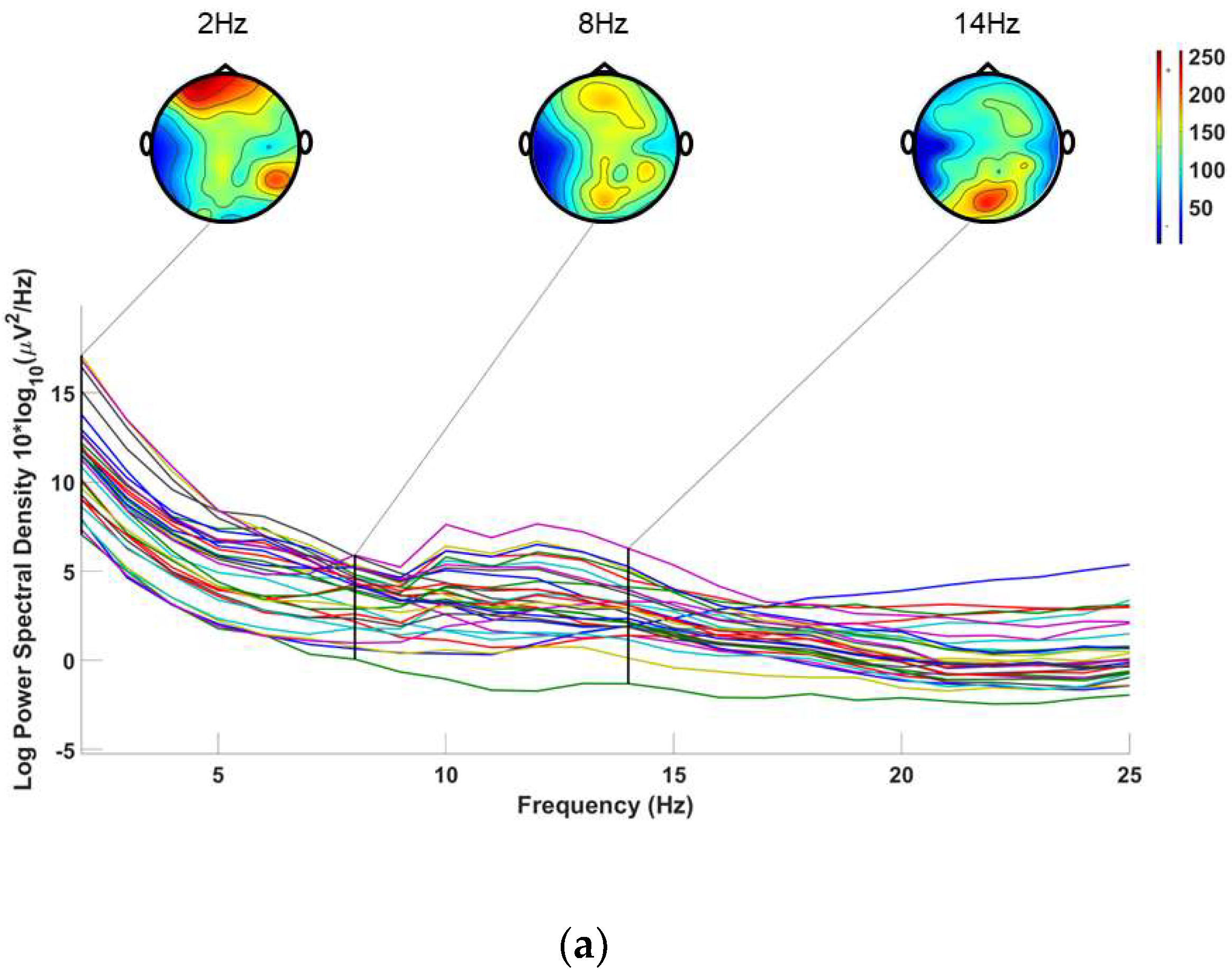 Micromachines | Free Full-Text | A Methodology for Enhancing SSVEP ...