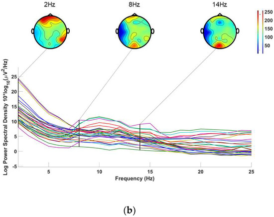Micromachines | Free Full-Text | A Methodology for Enhancing SSVEP ...