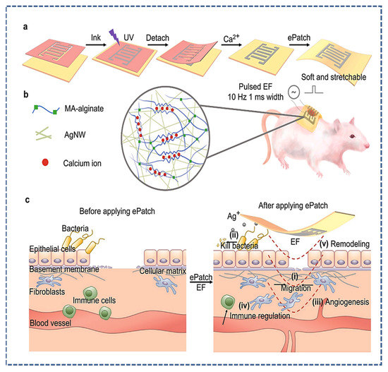 Current Progress in Conductive Hydrogels and Their Applications in ...