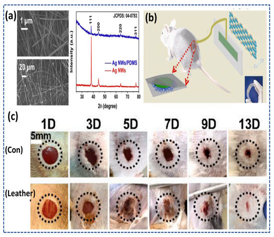 Current Progress in Conductive Hydrogels and Their Applications in ...