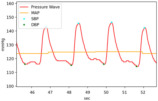 Micromachines | Free Full-Text | A Hemodynamic Pulse Wave Simulator ...
